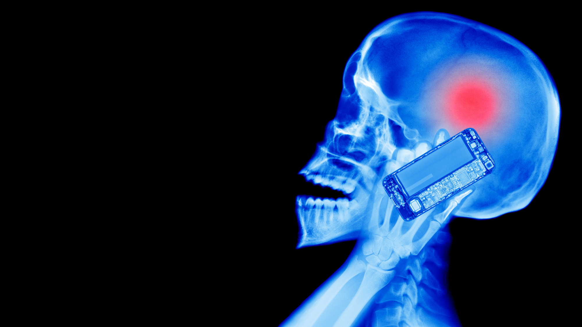 The science of cellphone radiation