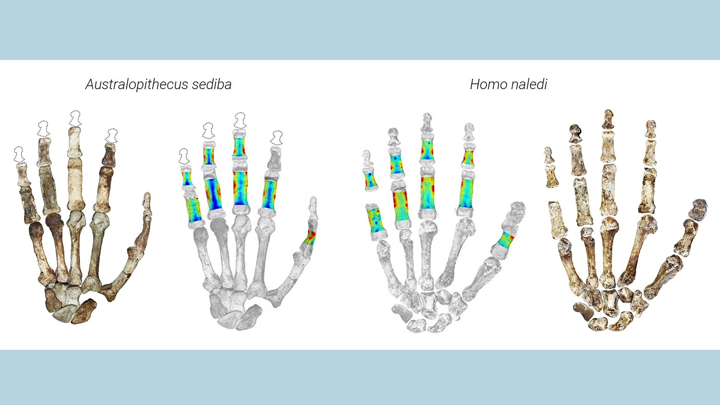 Early human ancestors used their hands to both climb trees and make tools