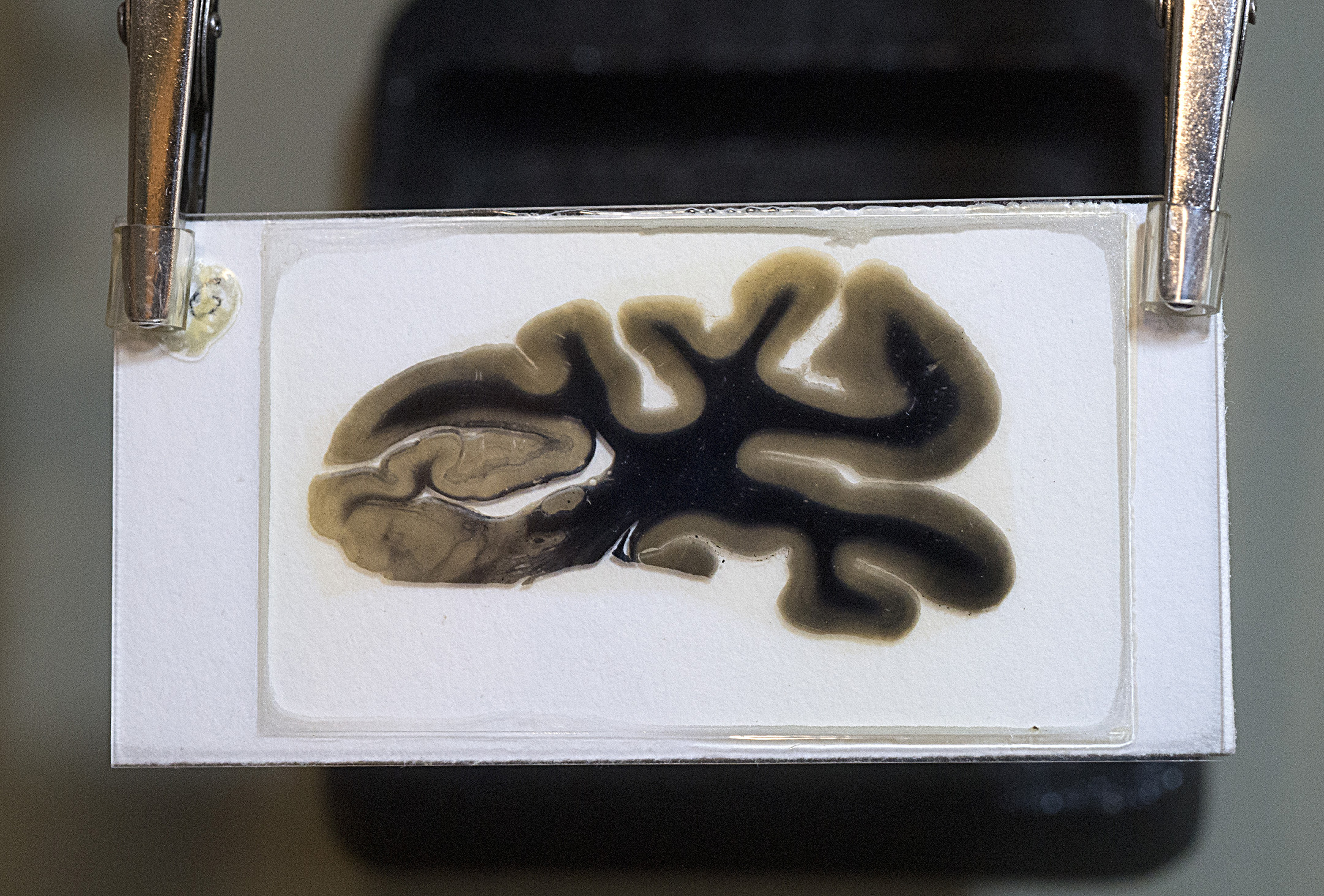 Physical features of Einstein’s brain befit a genius for the ages