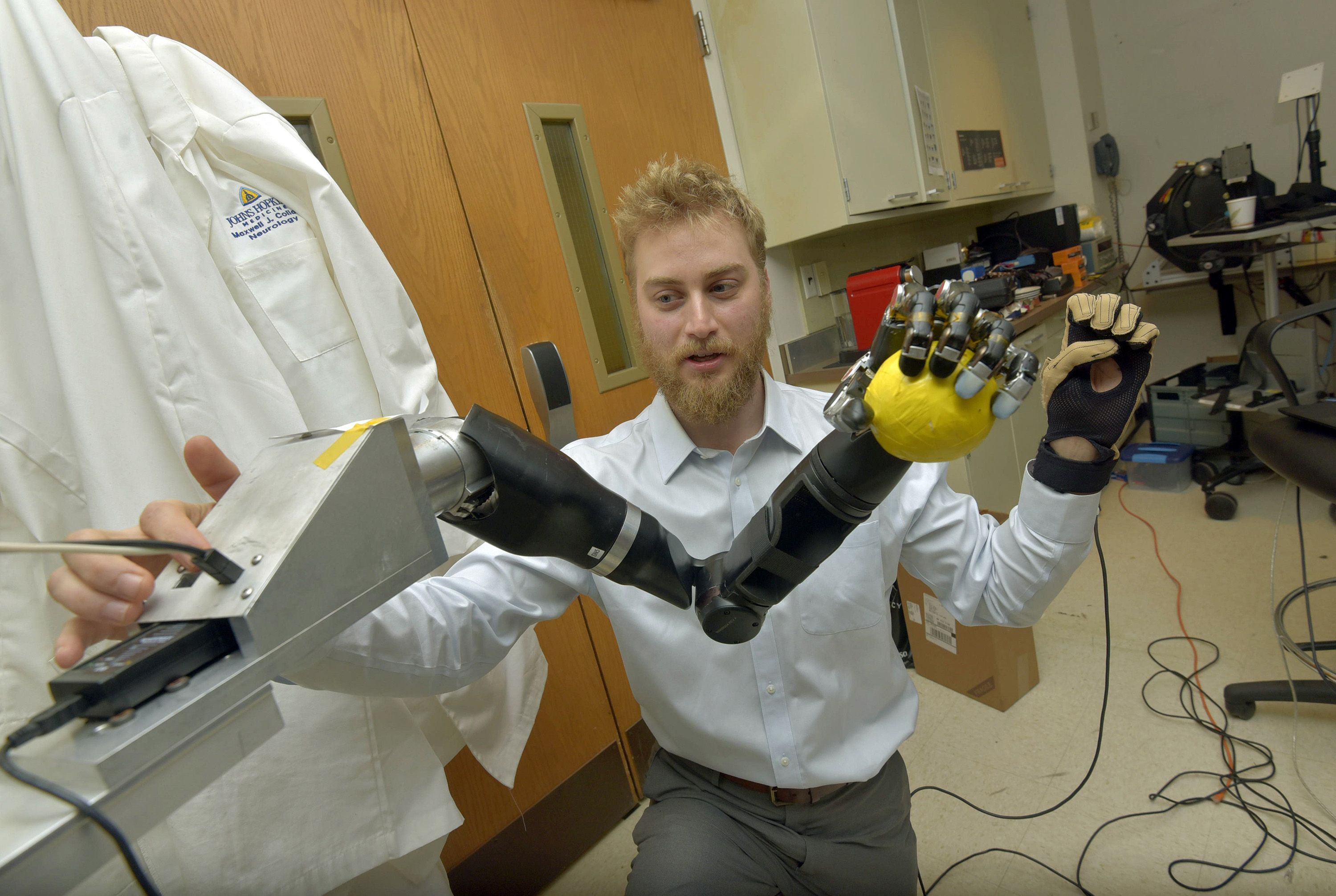 Patient moves prosthetic fingers with mind