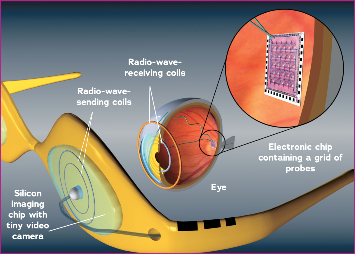 Developing artificial vision