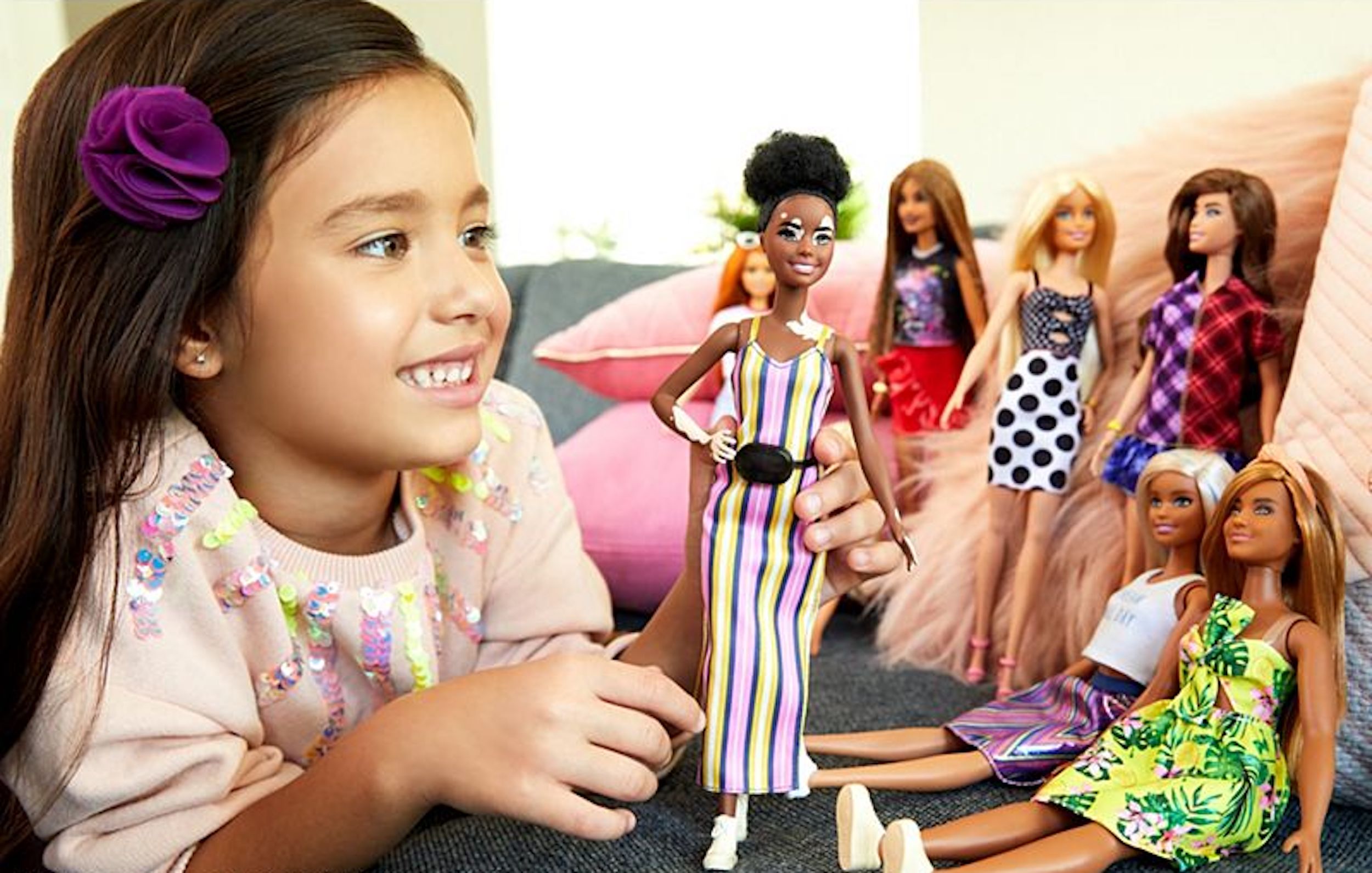 Barbie gets more diverse: Mattel unveils dolls with no hair, vitiligo