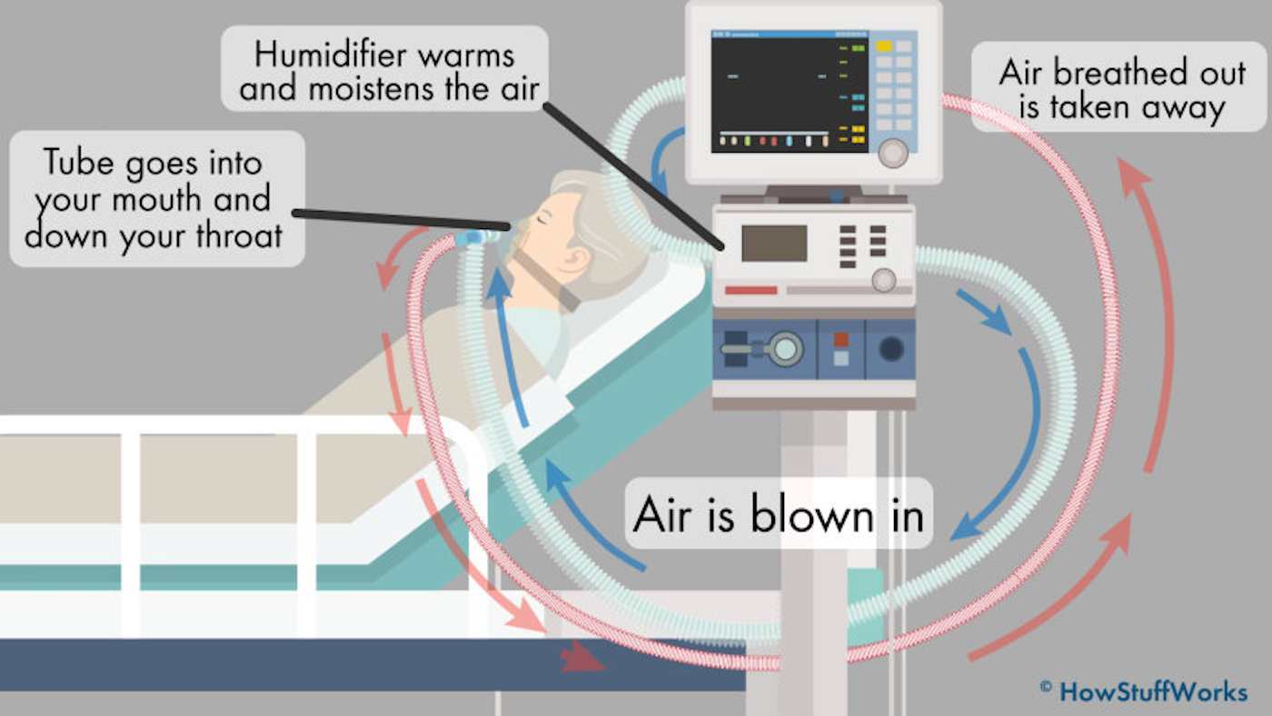 How do ventilators work?